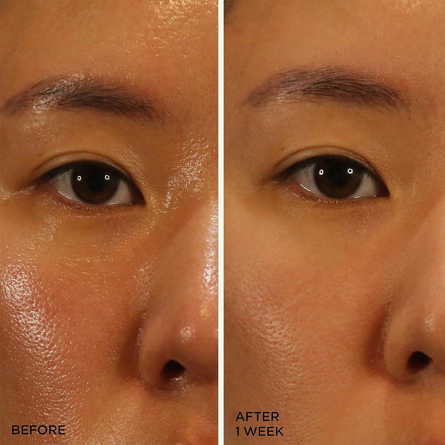 Tatcha Texture Tonic | Liquid Exfoliating Treatment 150ml | 5.0 fl. Oz ...