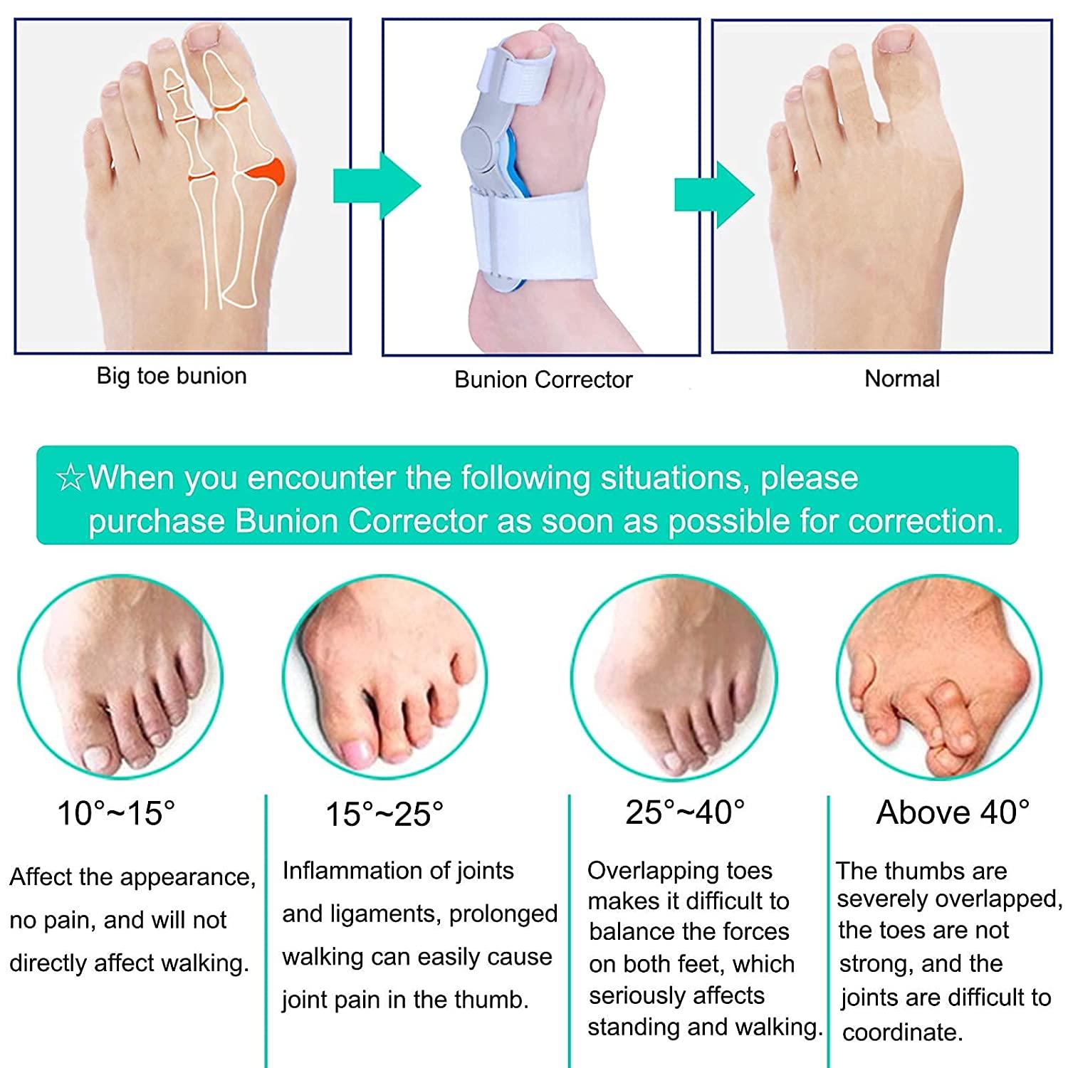 TANDCF Orthopedic Bunion Corrector for Women and Men - Adjustable Toe ...