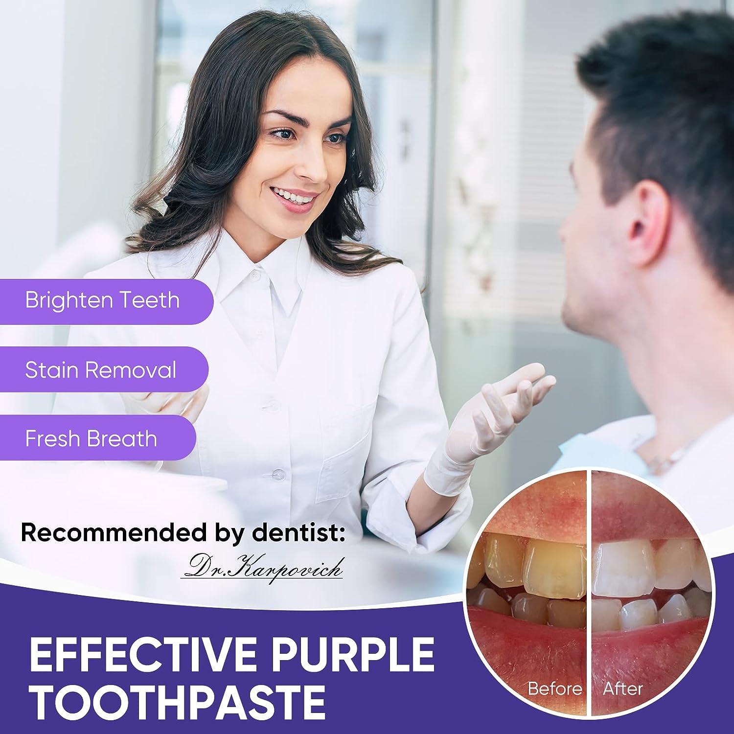 Purple Toothpaste for Teeth Whitening Purple Teeth Whitening - Purple ...