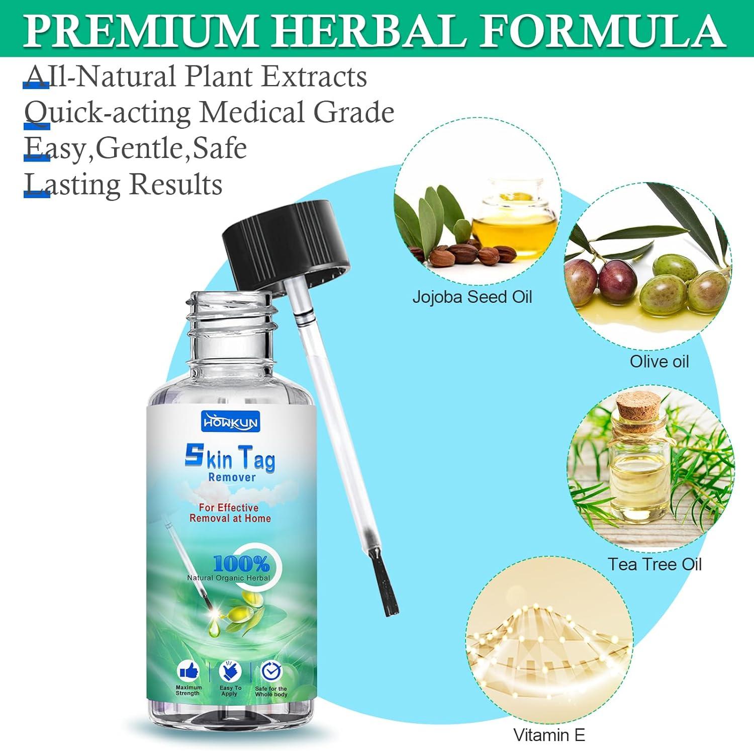 Skin Tag Removal & Wart Mole Remover Lotion 30ML - Fast-Acting ...