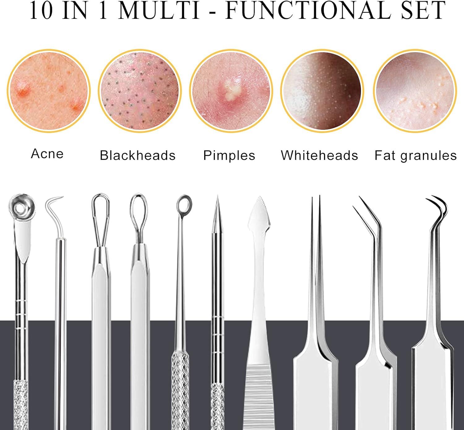 Professional Blackhead Remover Pimple Popper Tool Kit - Boxoyx 10Pcs ...