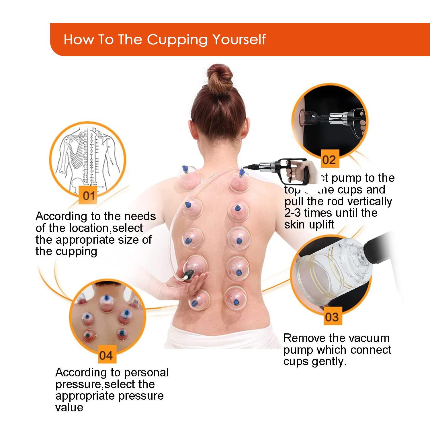 Cupping Jars Set - Traditional Chinese Cupping Tools for Pain Relief ...