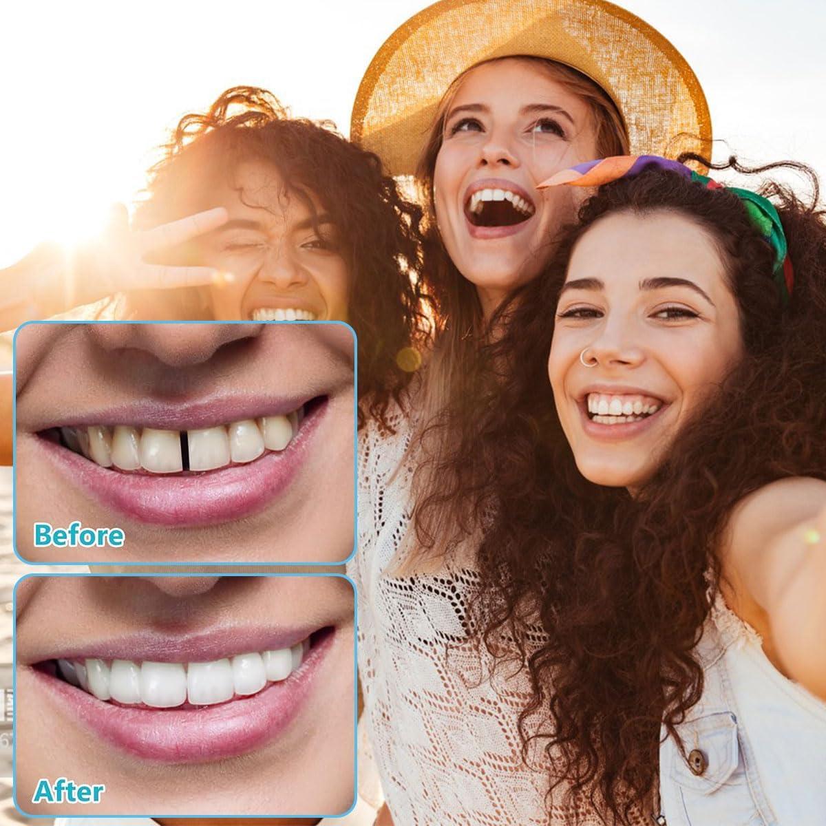 Buy High-Quality False Teeth Veneers | Cosmetic Tooth Covers & Provisional Dentures for a ...