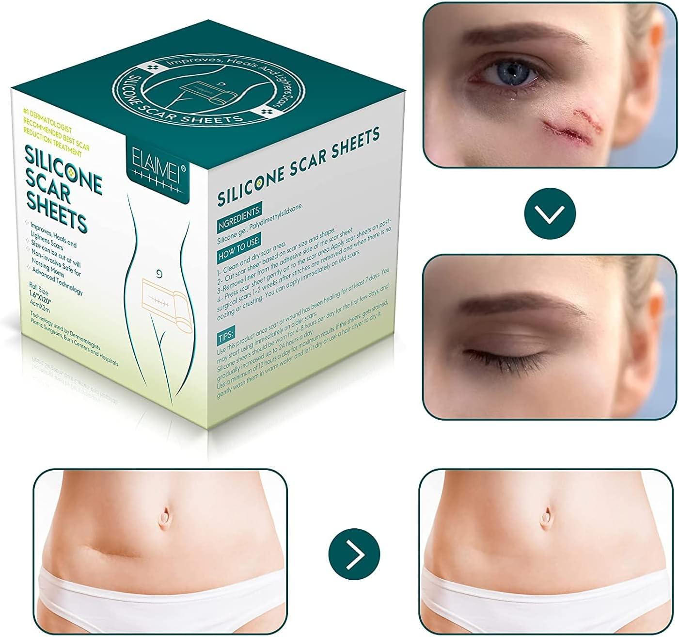 Soft Silicone Scar Sheets - Medical Grade, Waterproof & Reusable - 4CM ...