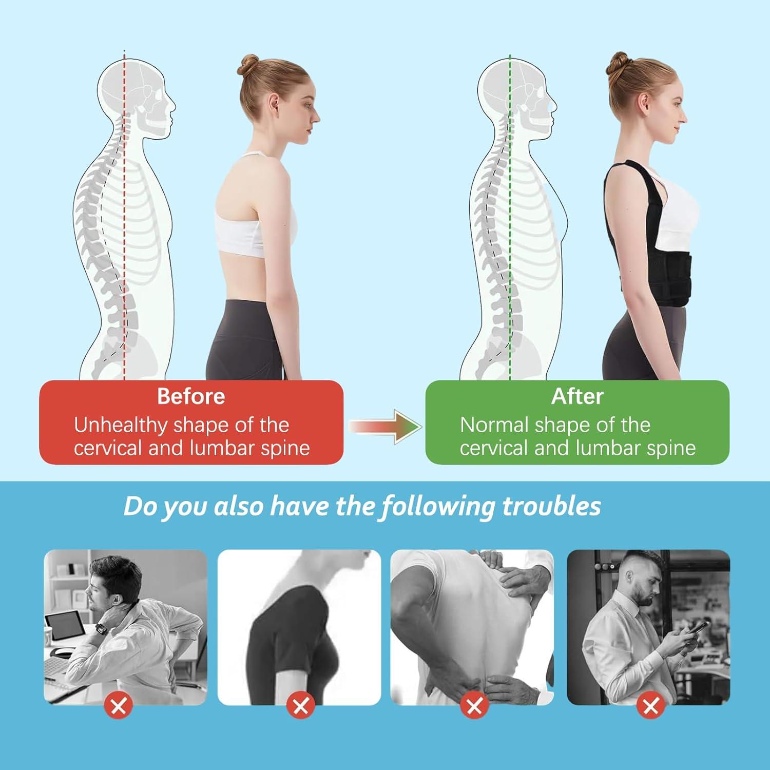 Adjustable Posture Corrector Brace for Men and Women - Back Support ...
