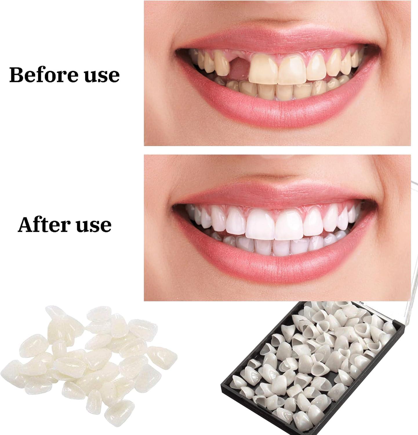 70PCS Temporary Tooth Crown Repair Kit - Durable Fake Teeth Cap for ...