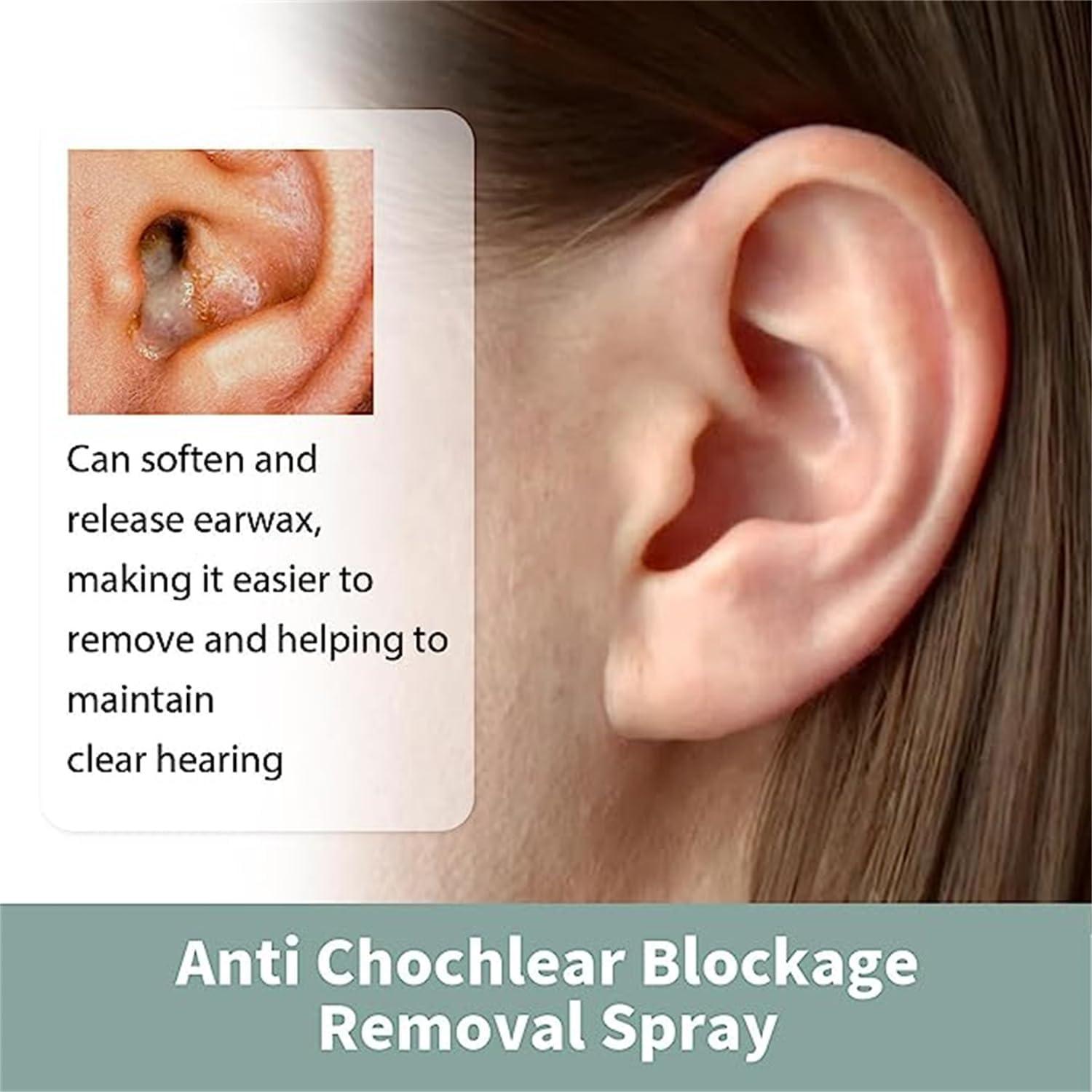 Earwax Removal Spray - Cochlear Blockage Dissolver & Ear Wax Cleaner (1 ...