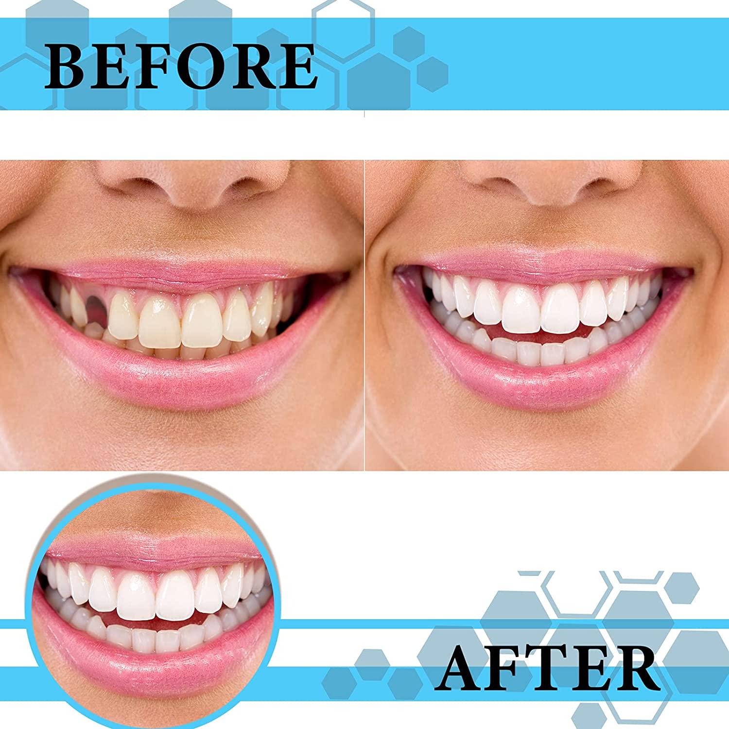 100 Pieces Resin Teeth Veneers for Halloween Cosplay, Scary Theme Party ...