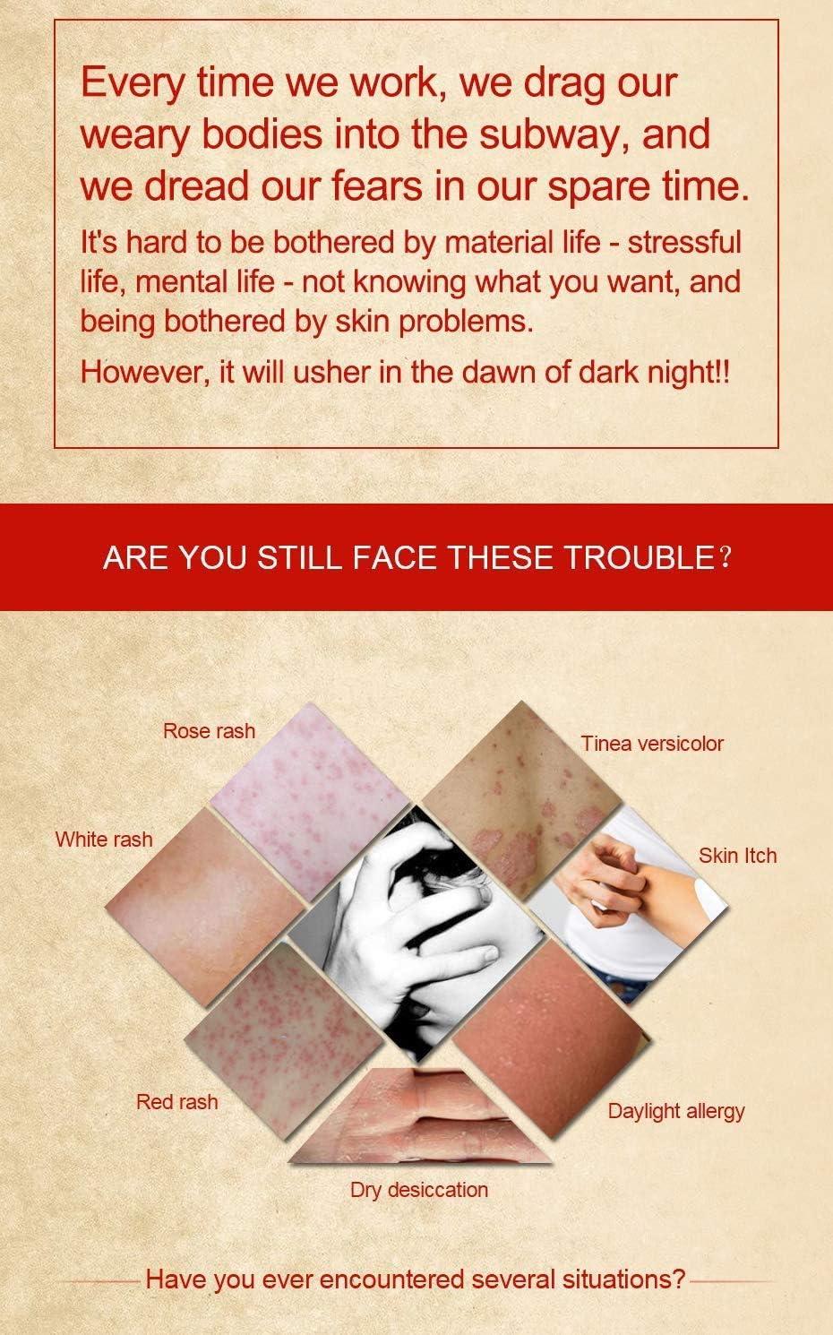 YDF Antibacterial Cream: Redness, Itchiness, Eczema, Rosacea, Cutitis ...