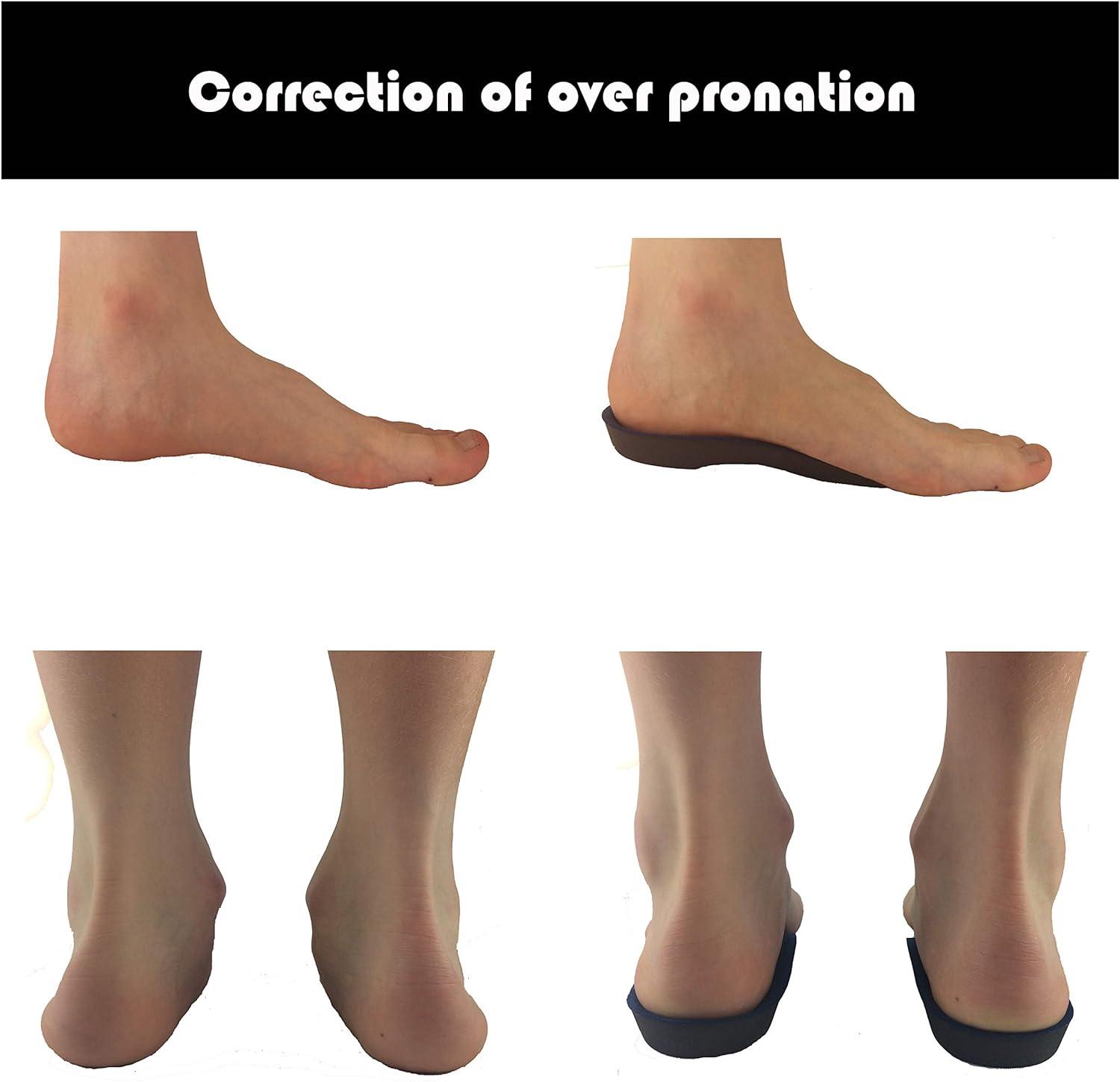 Orthotic Insoles for Plantar Fasciitis/Achilles Tendonitis | 2 Pairs ...