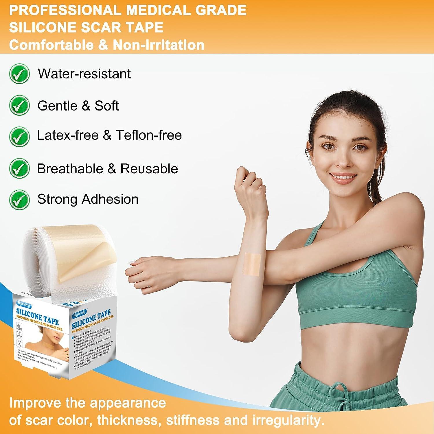 Professional Silicone Scar Sheet Tape Roll - Reusable Waterproof Scar ...