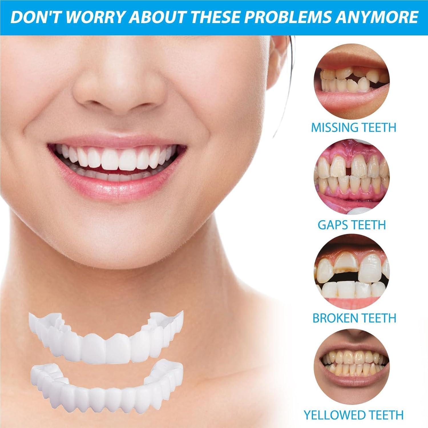 Wttfc 2 Pairs Dentures Temporary Denture Cosmetic Denture Temporary ...