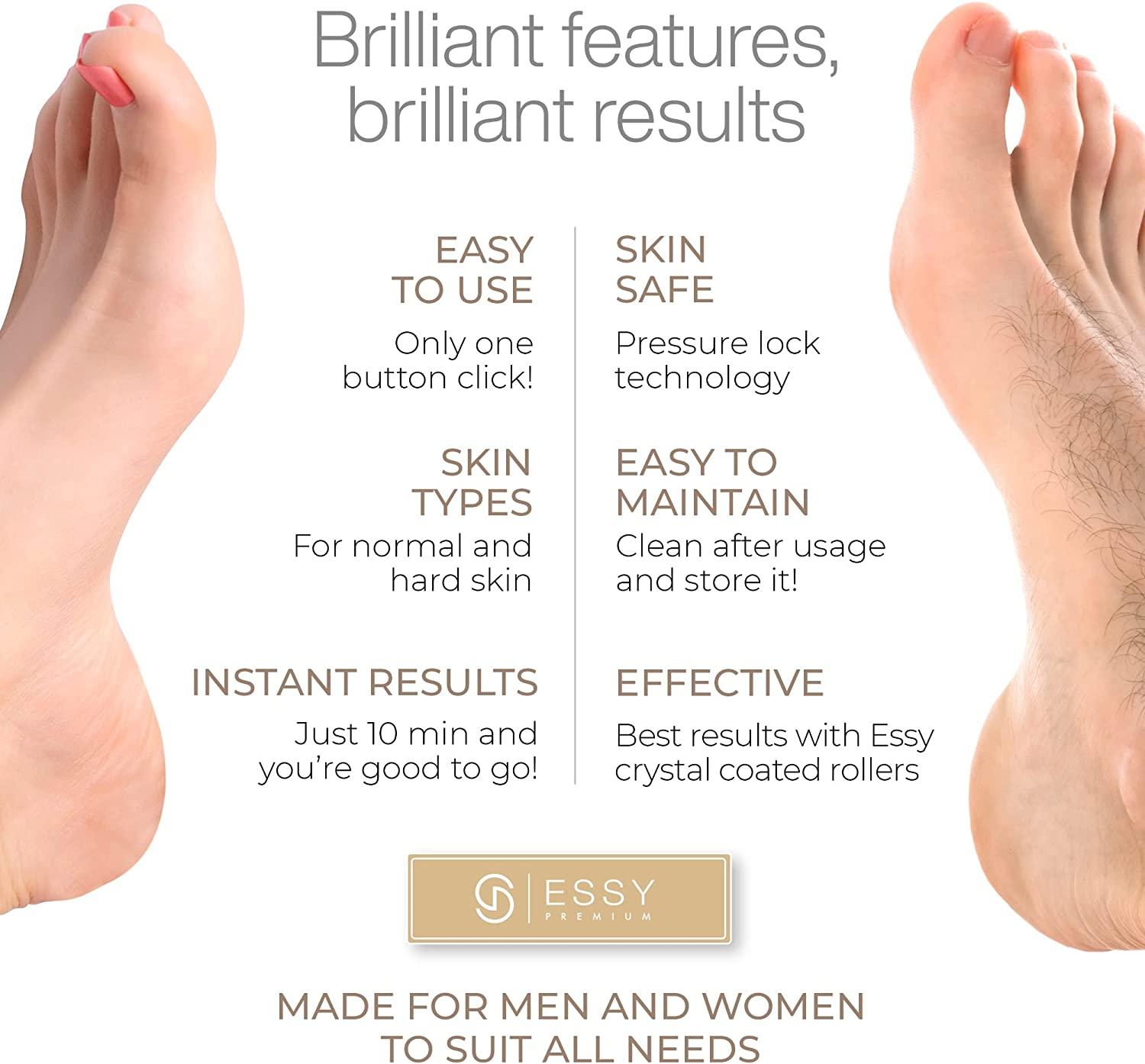 Essy Electric Foot Callus Remover Kit - Dead Skin Remover for Feet ...