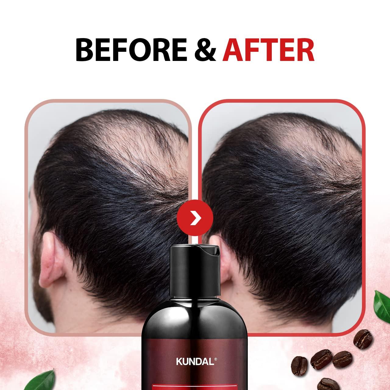 KUNDAL White Musk Anti-Hair Loss Caffeine Scalp Care Shampoo x2 - 300ml ...