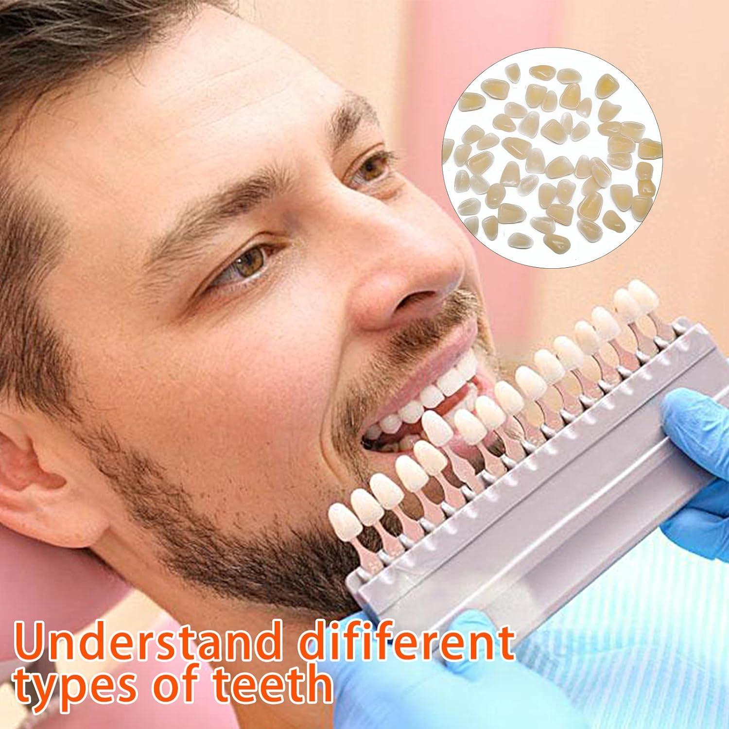 Temporary Tooth Repair Kit - Dental Beads Instant Veneer & Tooth ...