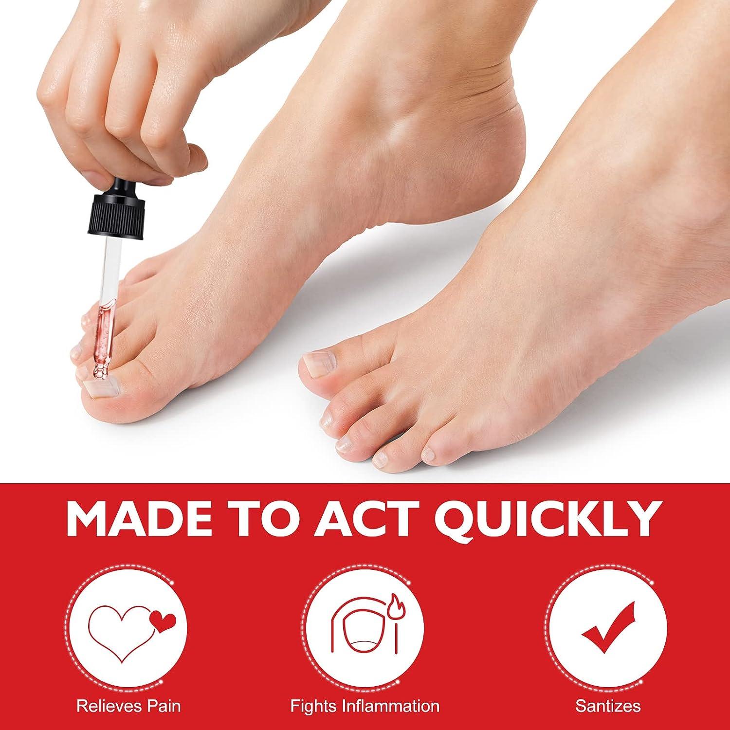 Professional Ingrown Toenail Treatment Drops | Easy Trimming ...