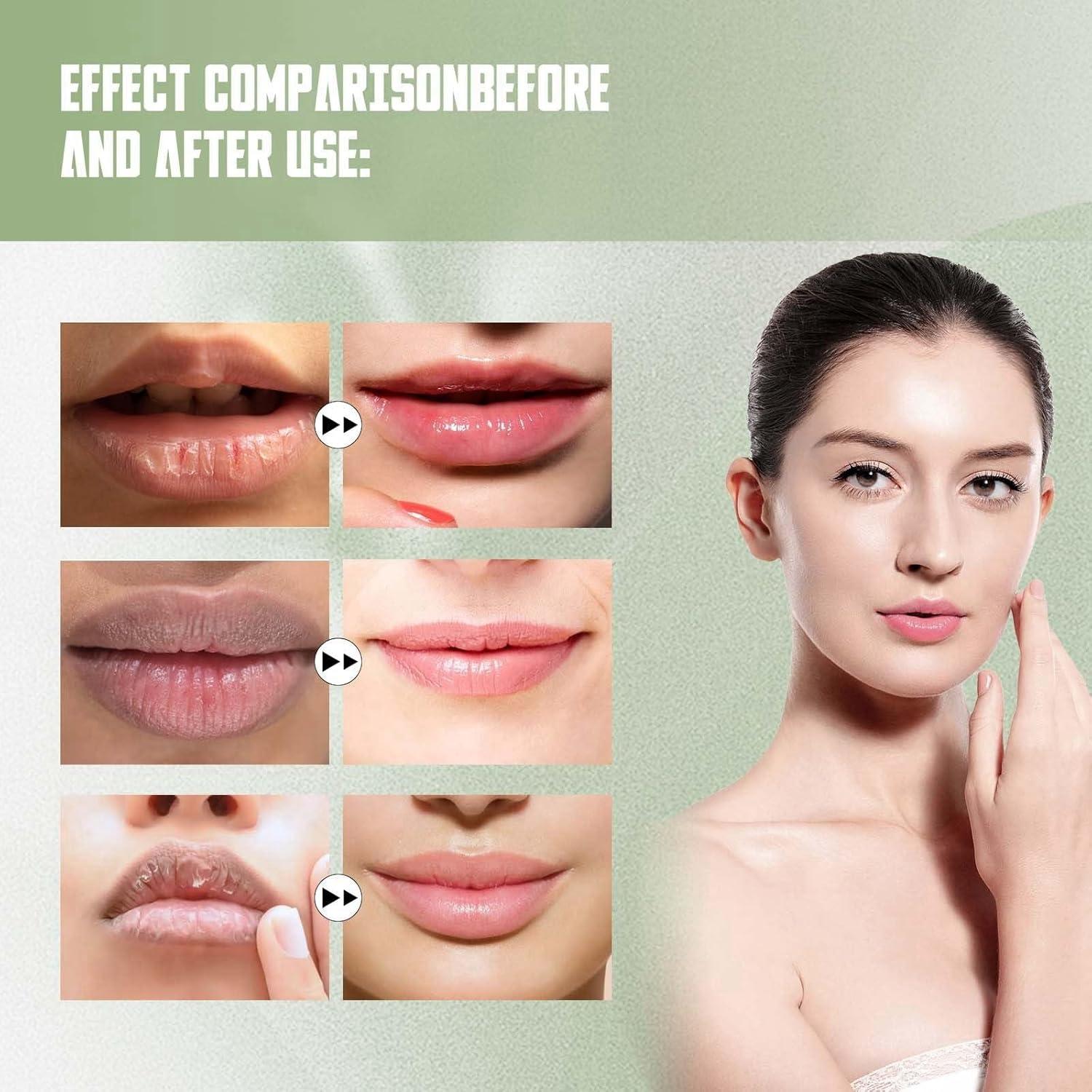 Lip Lightening for Dark Lips Lip Balm Stick Long Lasting Moisturizing ...