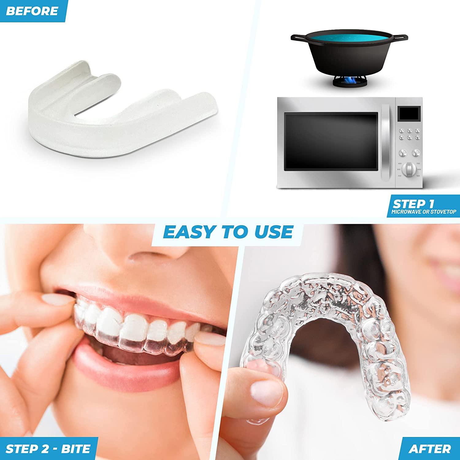 Restwell Dental Nightguard - Bruxing TMJ Relief, Anti Grinding Teeth ...