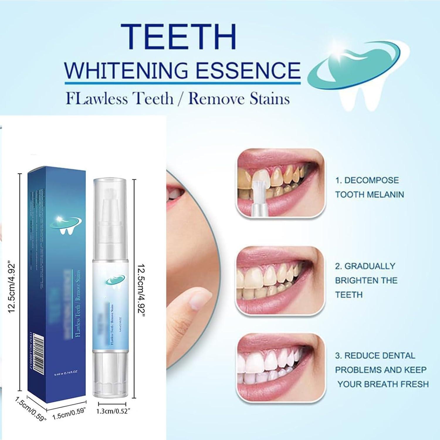 Teeth Whitening Abbey Set - 4 Piece Tooth Whitening Pen Kit for Quick ...