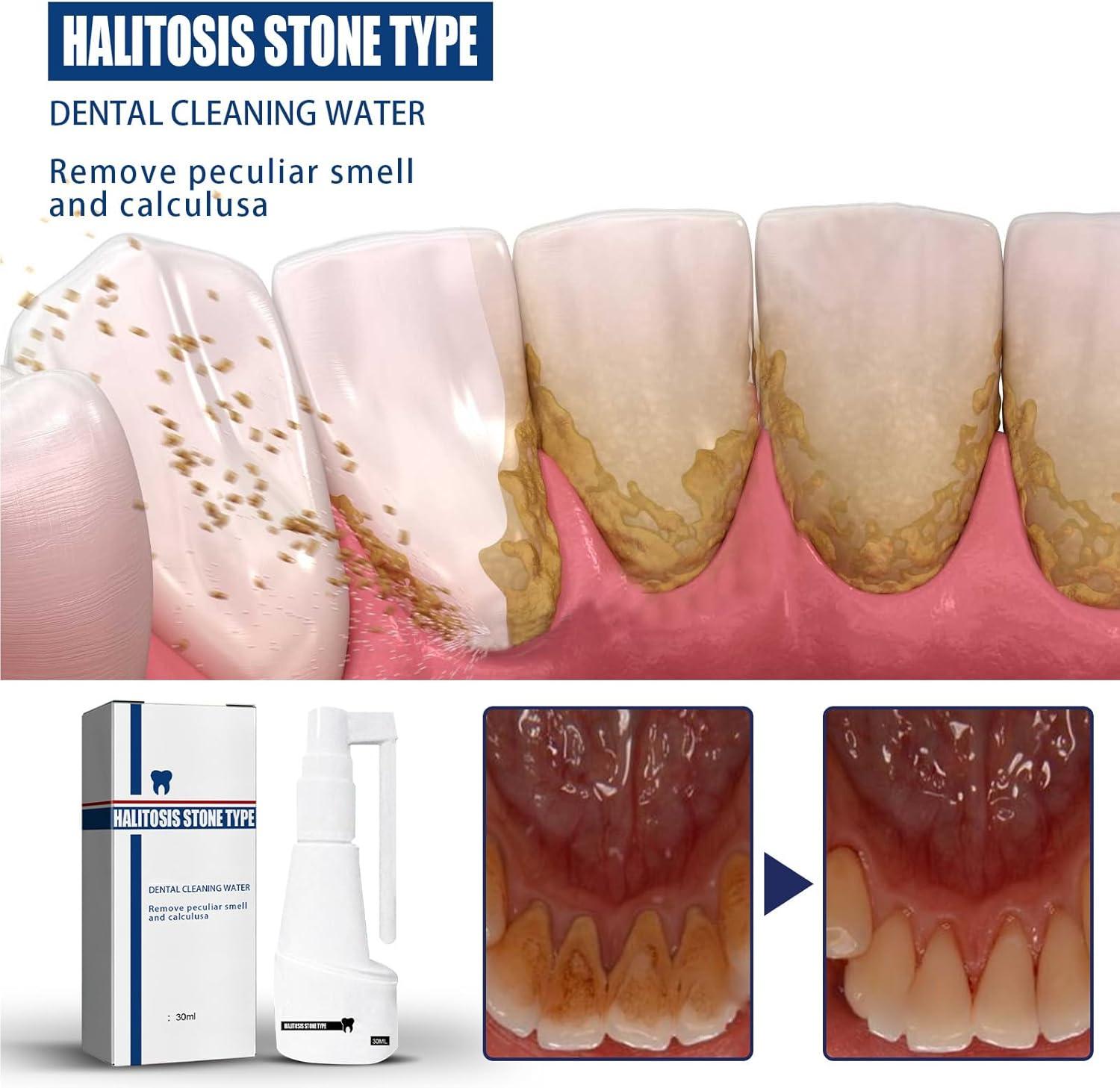 Ultimate Tooth Whitening Spray | Remove Tartar & Yellow Stains - Fresh ...