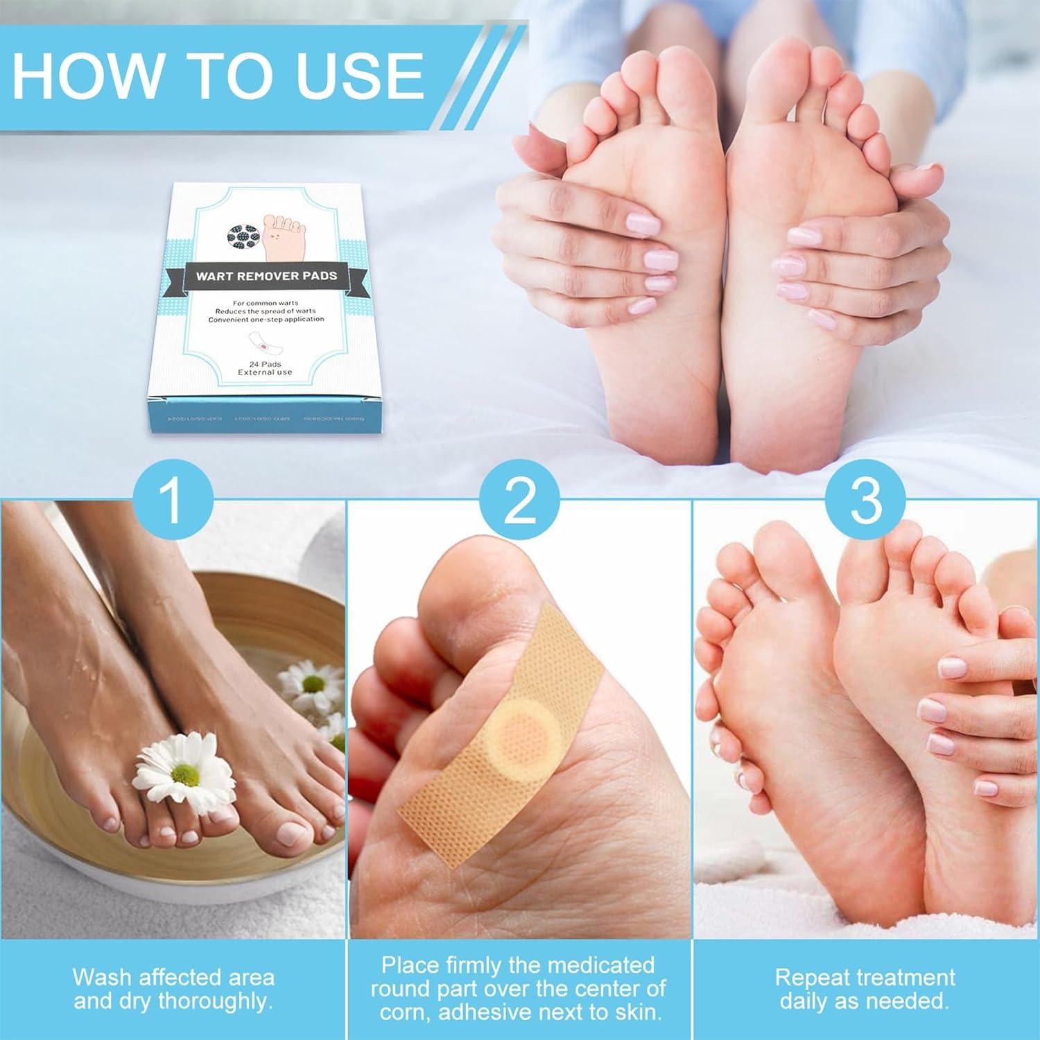 Wart Remover Plasters for Hands & Feet - Corn & Verruca Removal ...