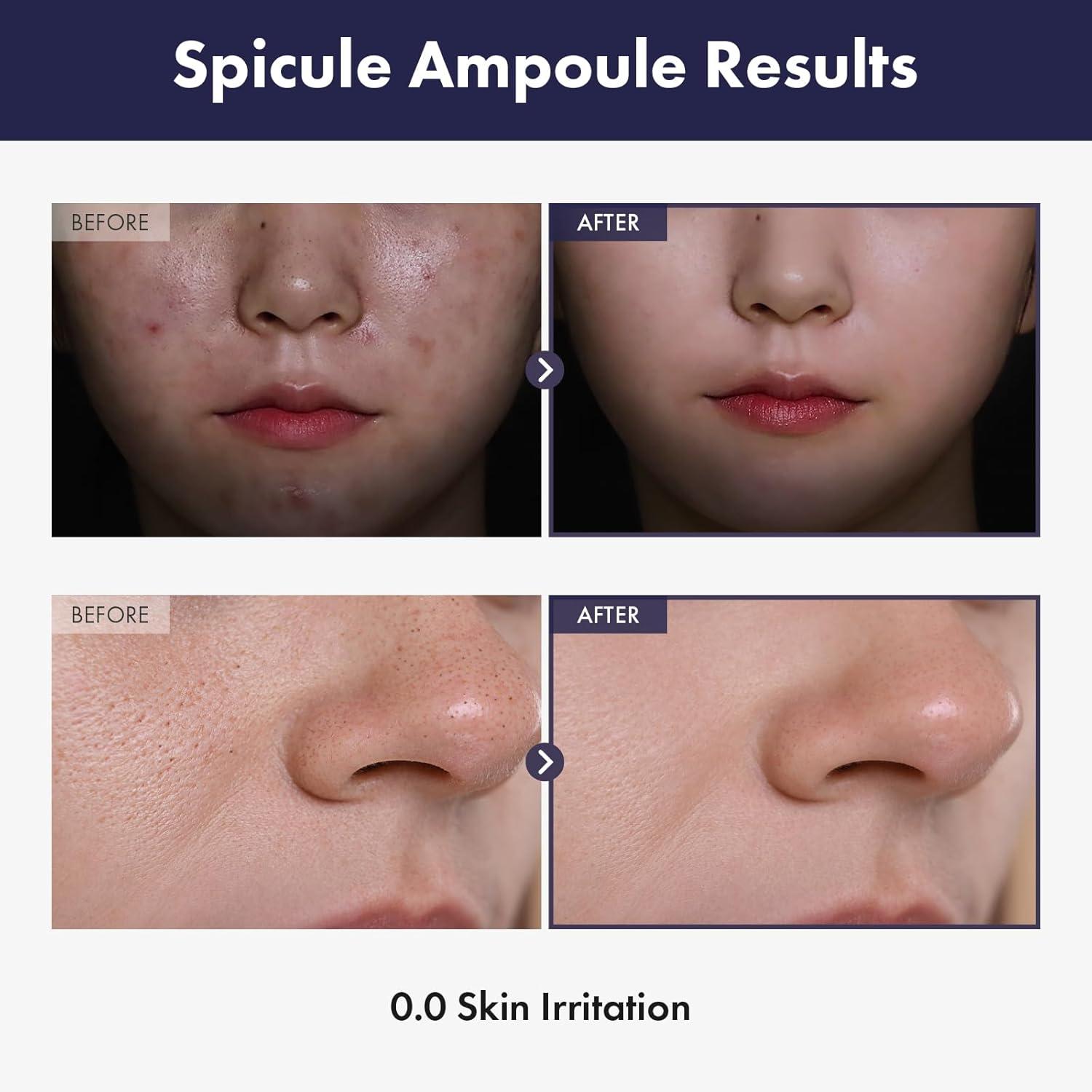 Real Spicule Ampoule 30 000 Shots - Niacinamide & Amino Acid Pore ...
