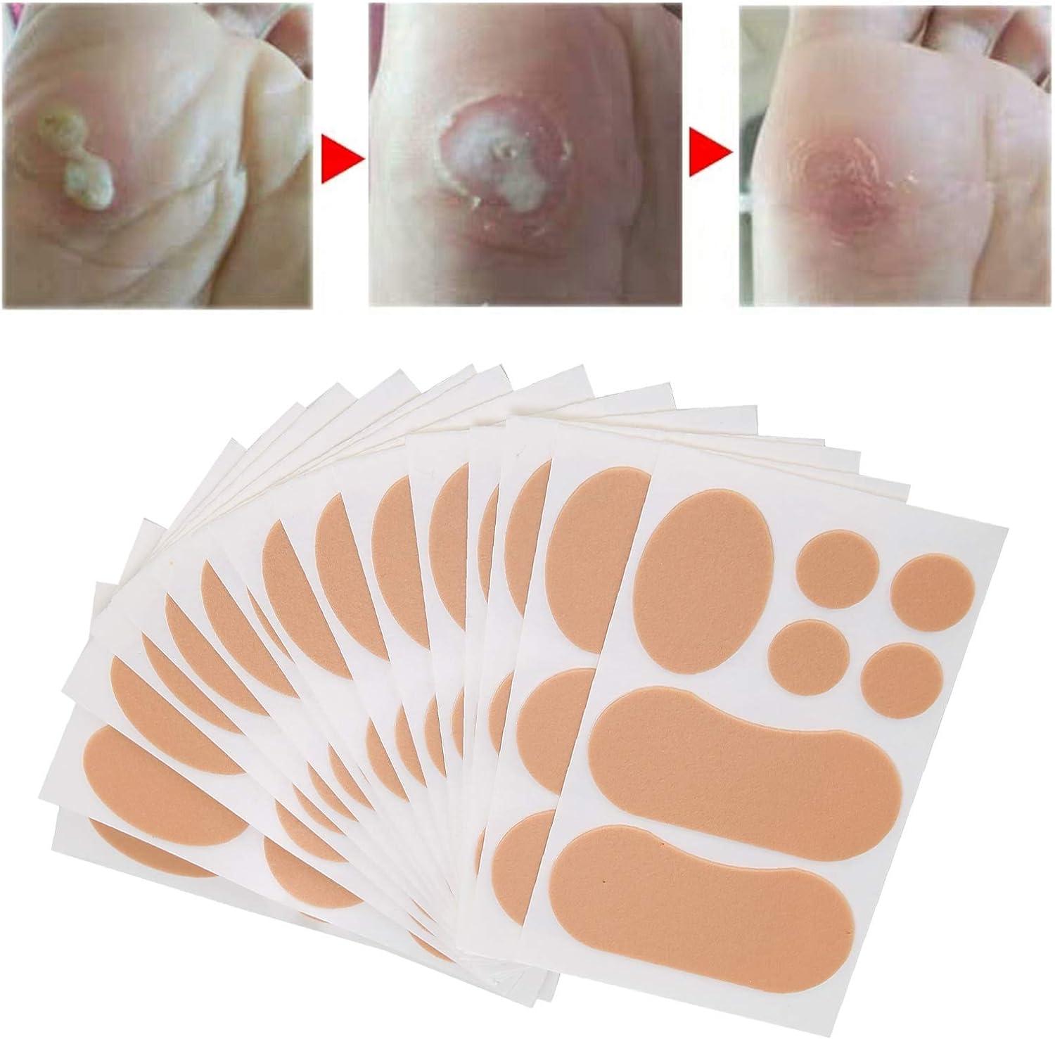 Alvinlite Moleskin Blister Plasters for Feet 15 Sheets Foot Care Tape ...