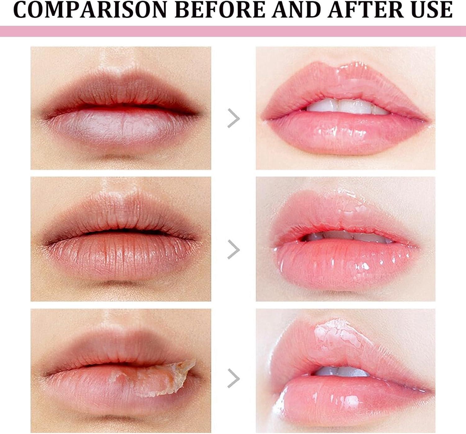 Lip Balm Set Moisturizing Lip Care Set Fruit Flavor Lip Balm Stick Lip ...