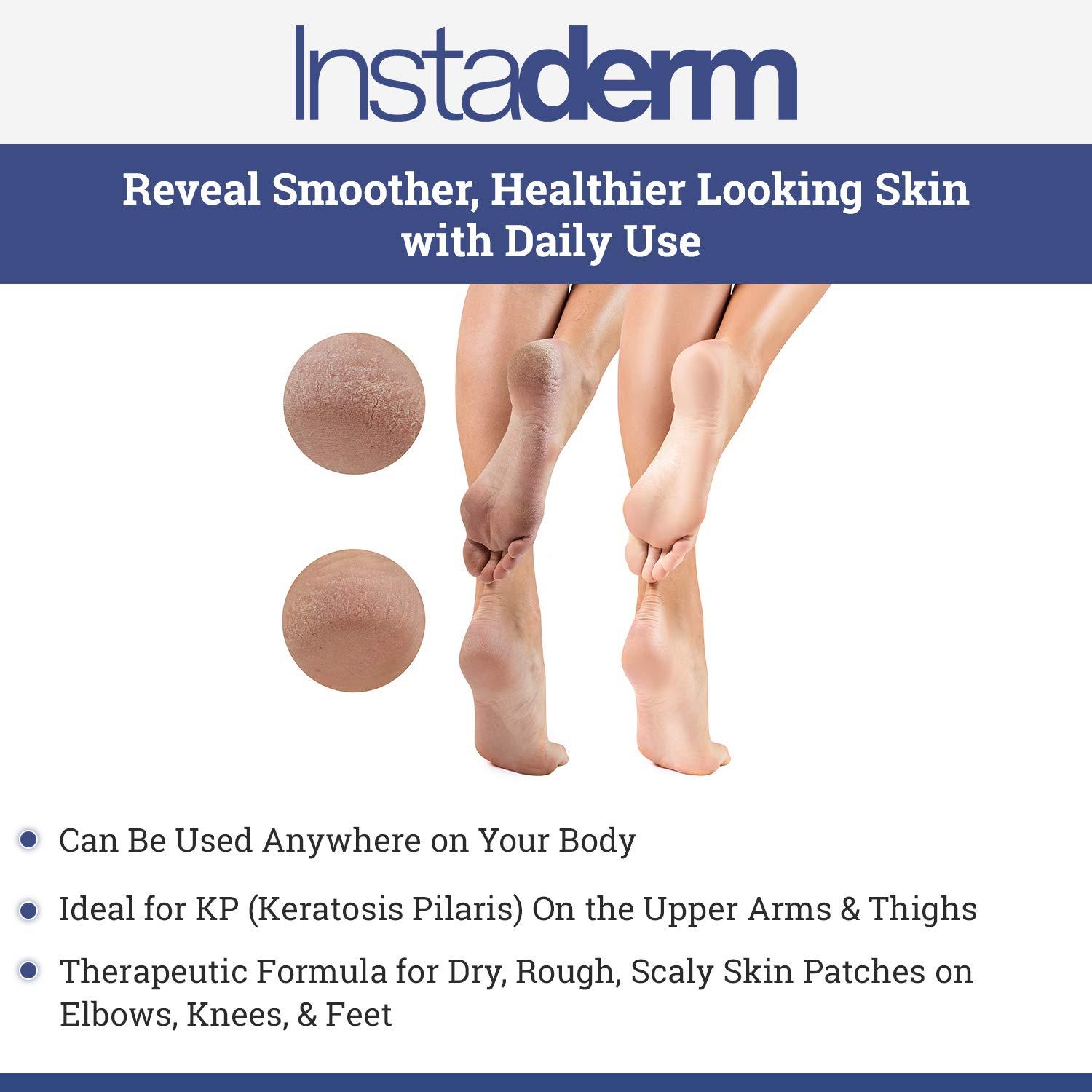 Keratosis Pilaris Treatment - KP Bump Eraser Lotion | Smoothing ...