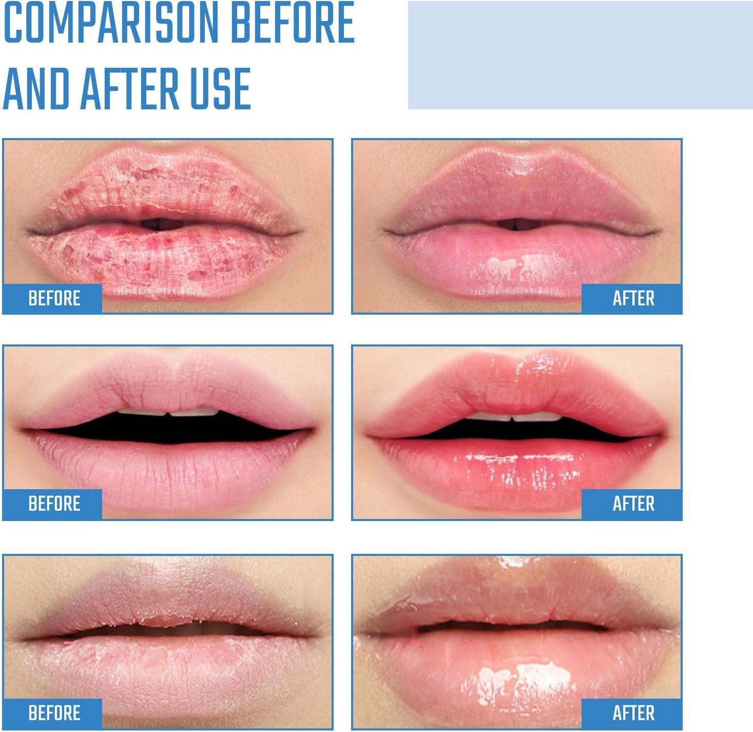 Collagen Lip Mask Pink Moisturizing Lip Patch Natural Collagen Lip Mask ...