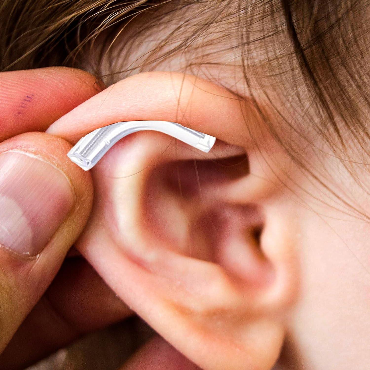 Silicone Ear Corrector Protruding Support Patch for Auricle Valgus ...