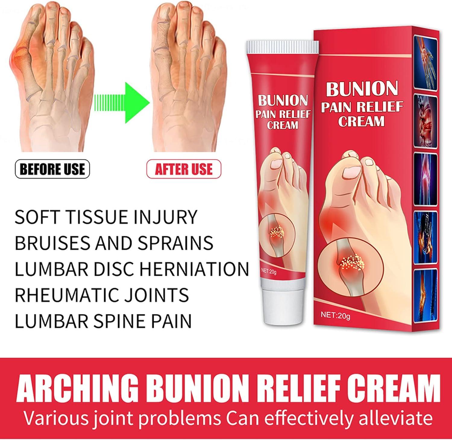 Bunion Pain Relief Cream - Soothing Bunion Relief & Inflammation ...