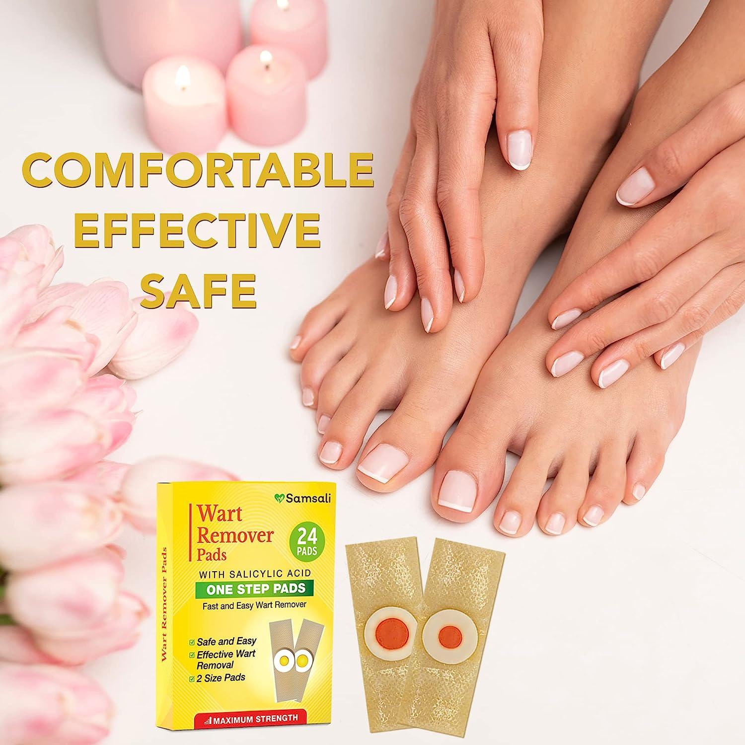 Samsali Highly Potent Wart Remover Treatment - 24 Pads for Finger, Hand ...