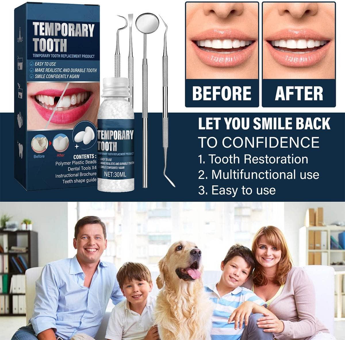Temporary Tooth Repair Kit with Mirror Tools for Missing & Broken Teeth ...