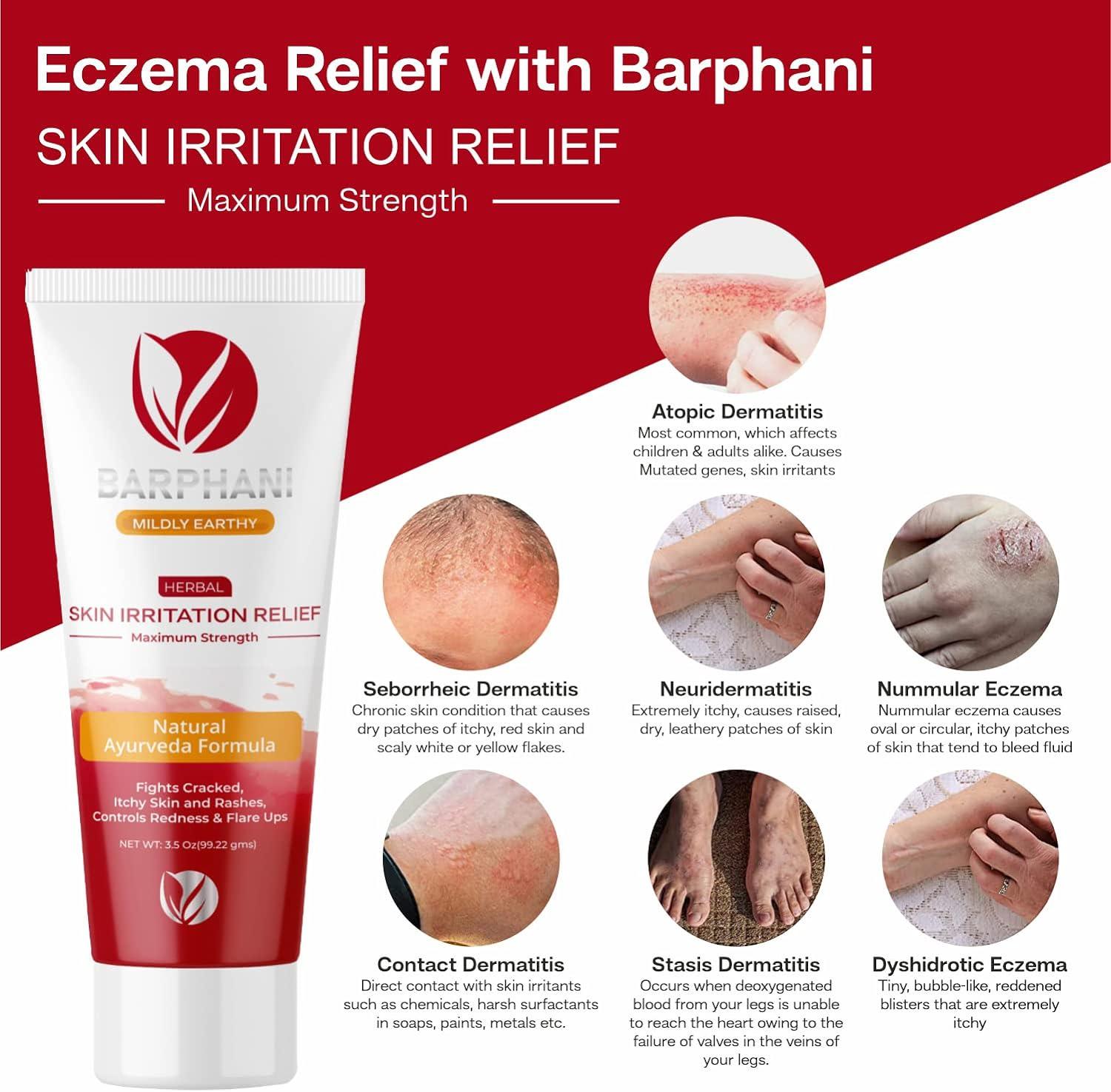 Barphani Cream: Natural Ayurvedic Soothing Relief for Skin Issues - Max ...