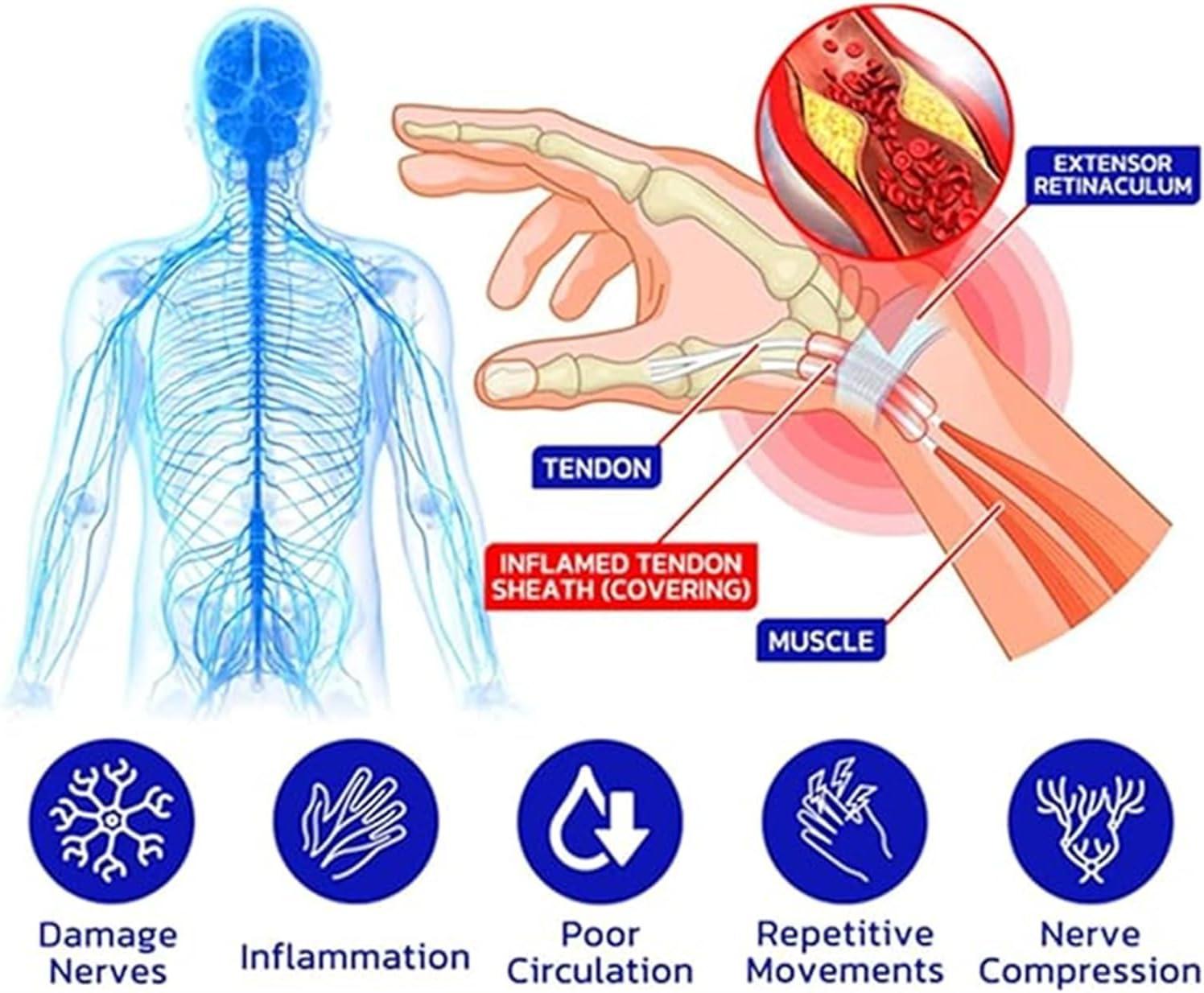 Numbfix Hand and Foot Spray - Effective Relief for Tenosynovitis ...