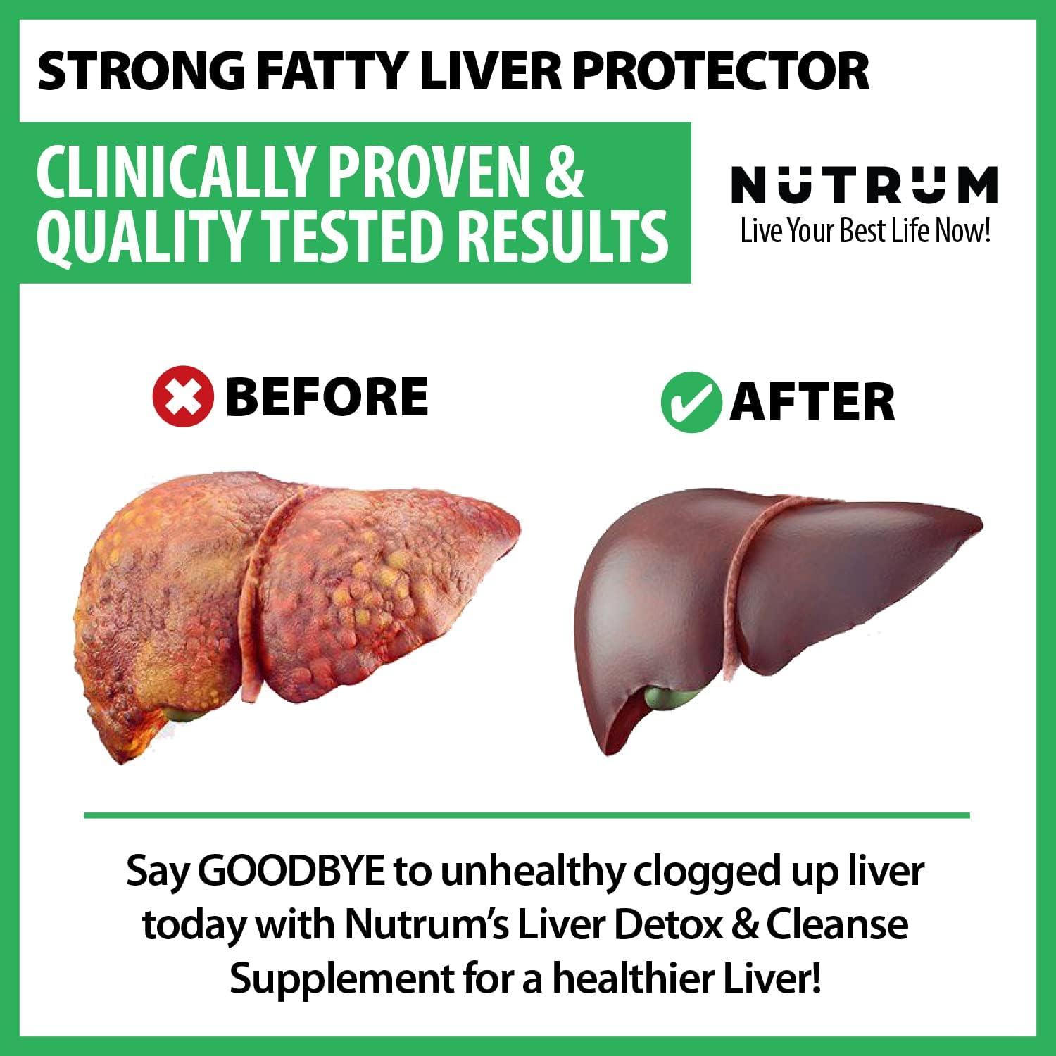 Nutrum Liver Cleanse & Detox Supplement - Herbal Formula with Milk ...