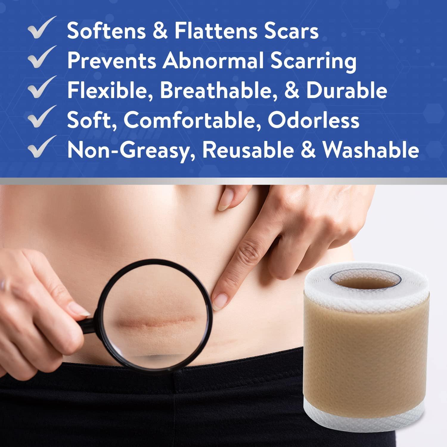 Aroamas Silicone Scar Sheets 1.6x60 - Soften & Flatten C-Section ...