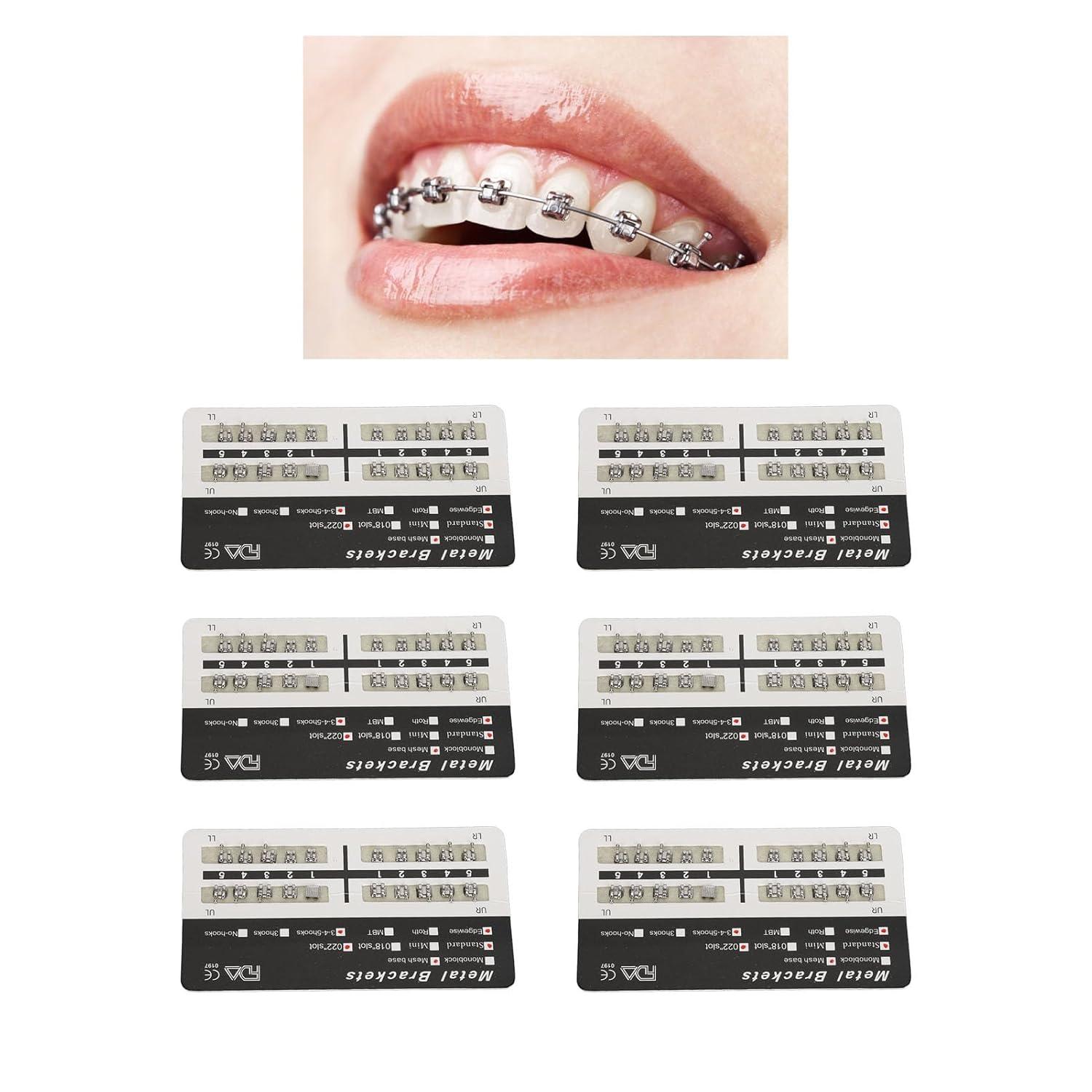 Orthodontic Braces - 200 Pack High Polished Metal Braces in Black ...