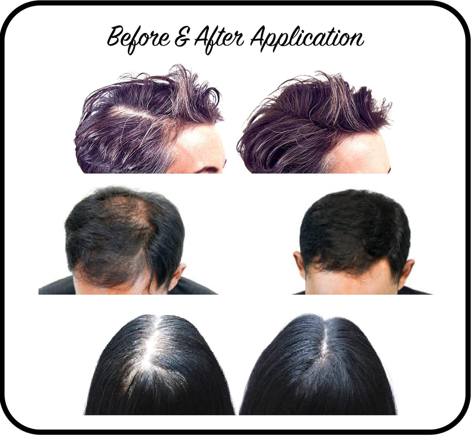 THICKIFY Hair Fibres 28g Bottle - Natural & Undetectable Hair Thickener ...