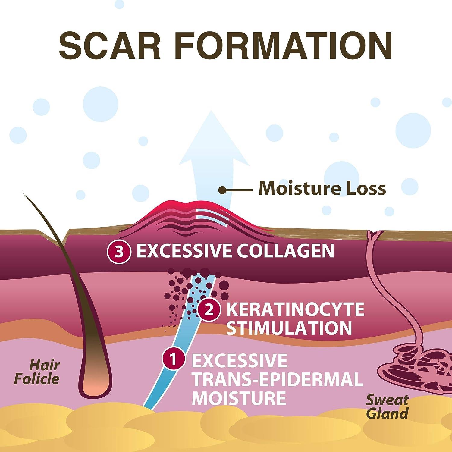 Xeragel 100% Silicone Scar Treatment Ointment Clinically Proven to ...