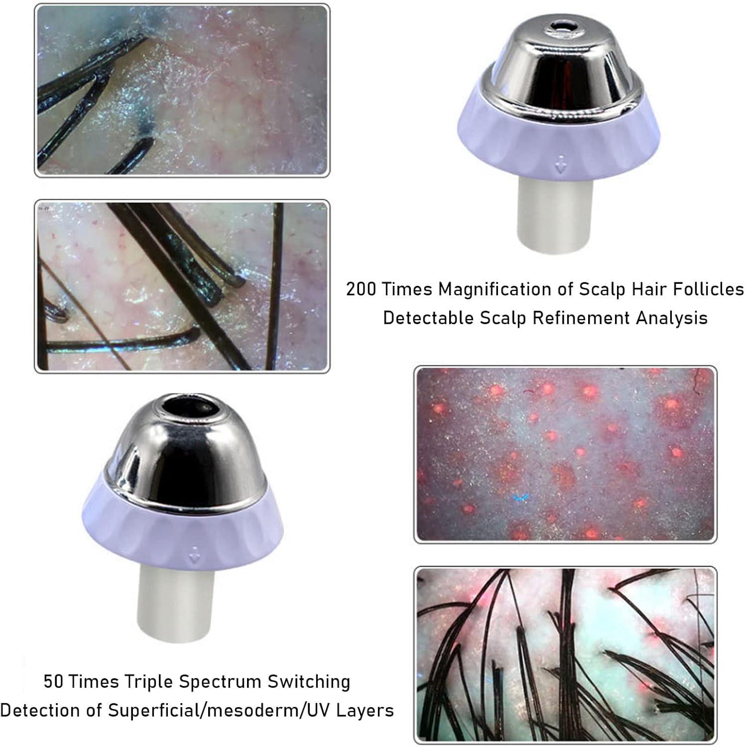 Skin Diagnosis Hair Analyzer 11 Inch LCD Screen Digital Scalp Hair ...