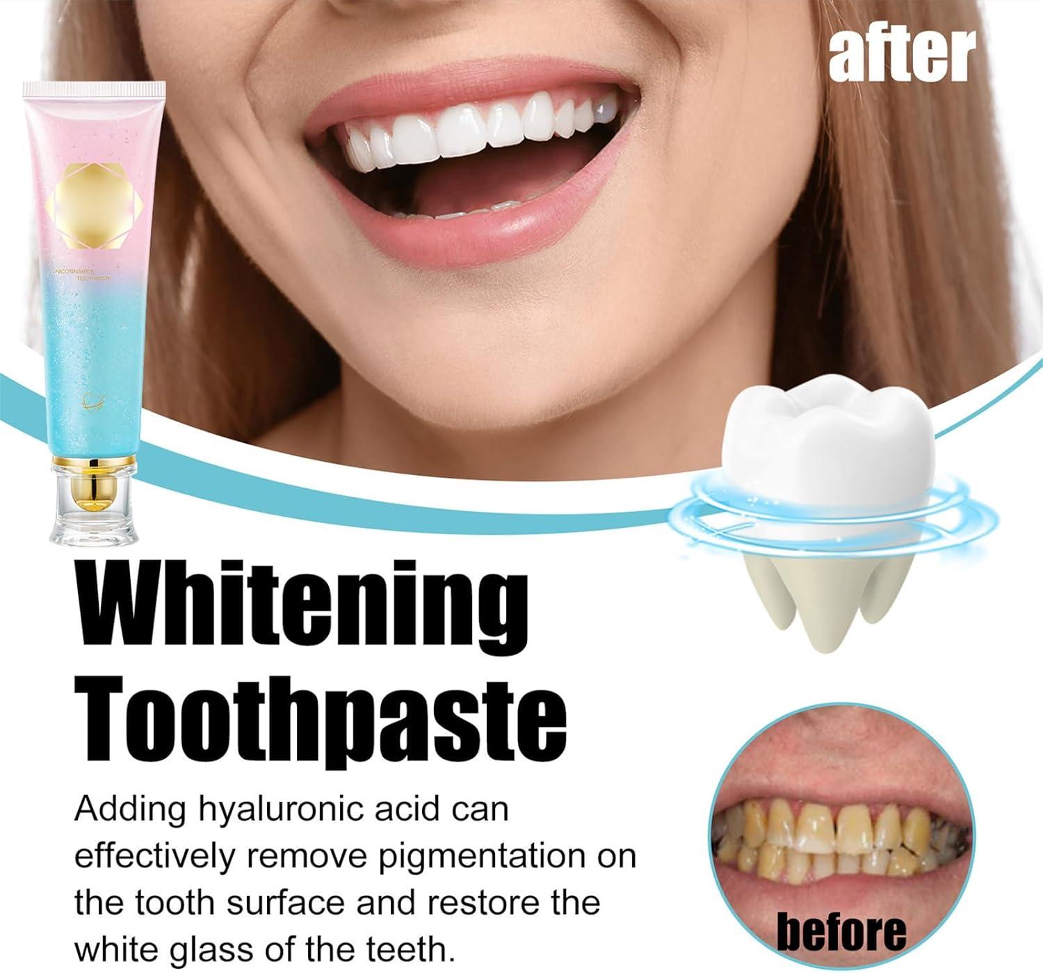 Naturalhall Niacinamide Whitening Toothpaste | Intensive Whitening for ...