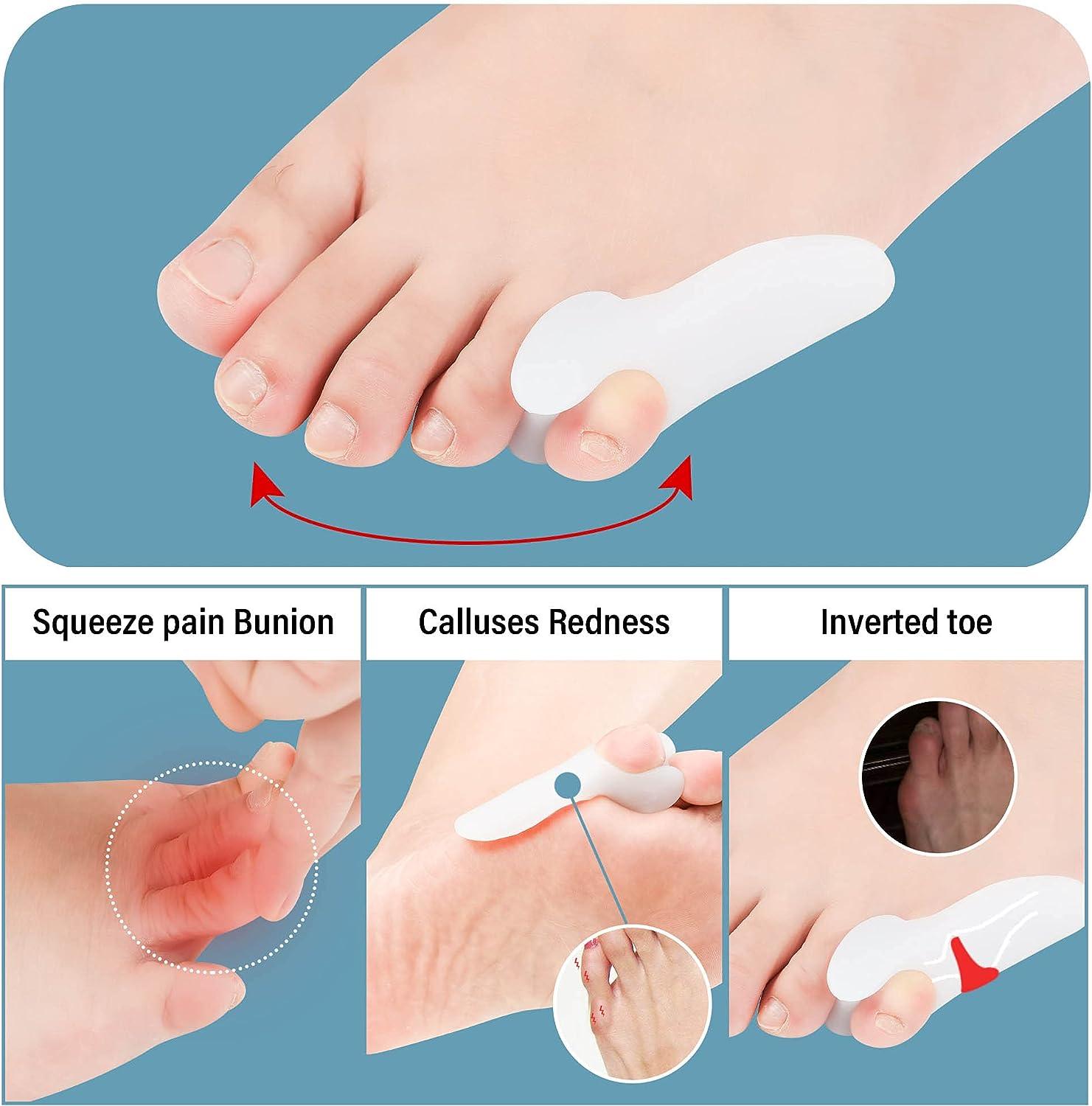 Pinky Toe Separator Gel Bunionette Protector - 6 PCS Tailors Bunion ...
