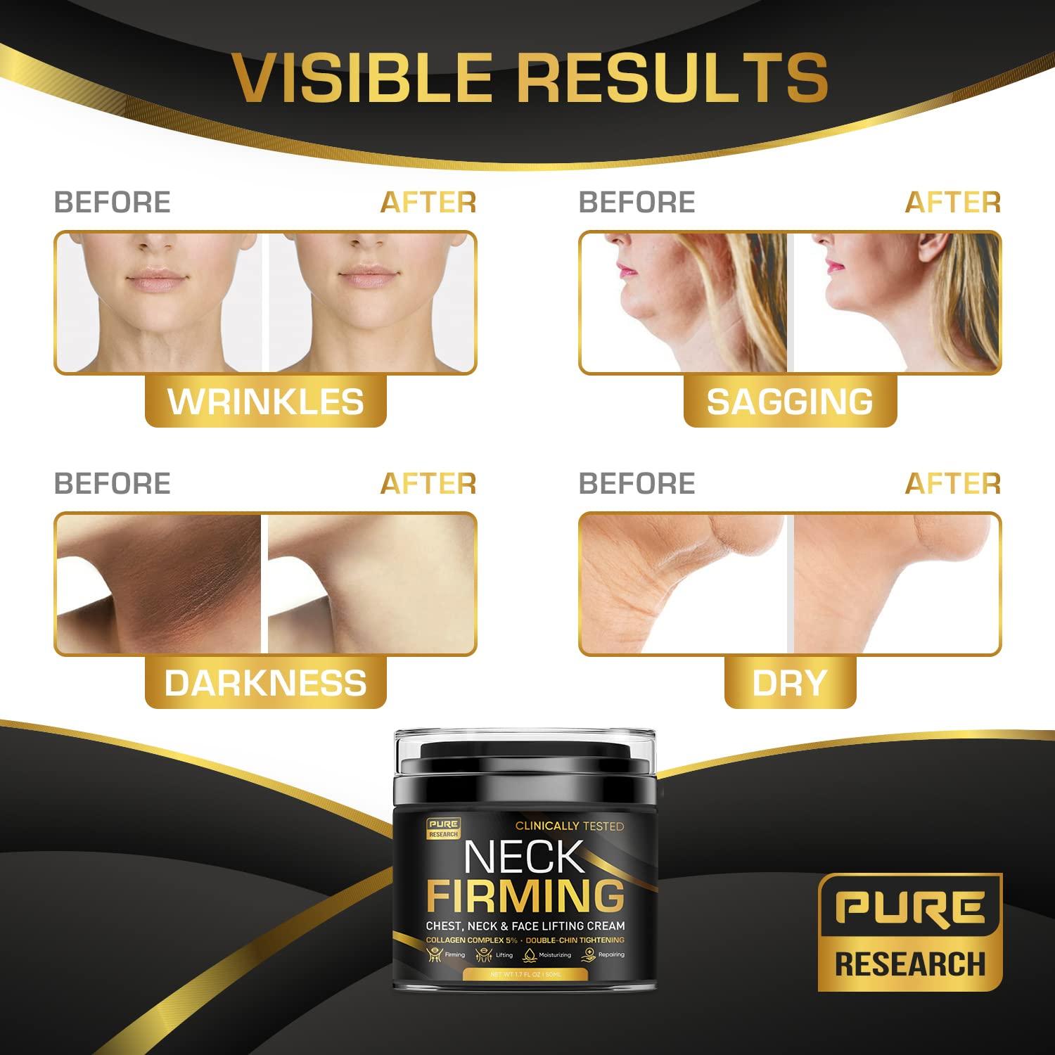 Neck Firming Cream â€“ Anti-Wrinkle & Double Chin Reducer â€“ Collagen ...