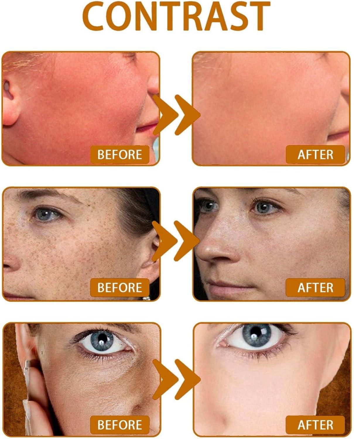 Snail Sunscreen SPF 50 Snail Mucin Sunscreen Stick UVA/UVB Protection ...