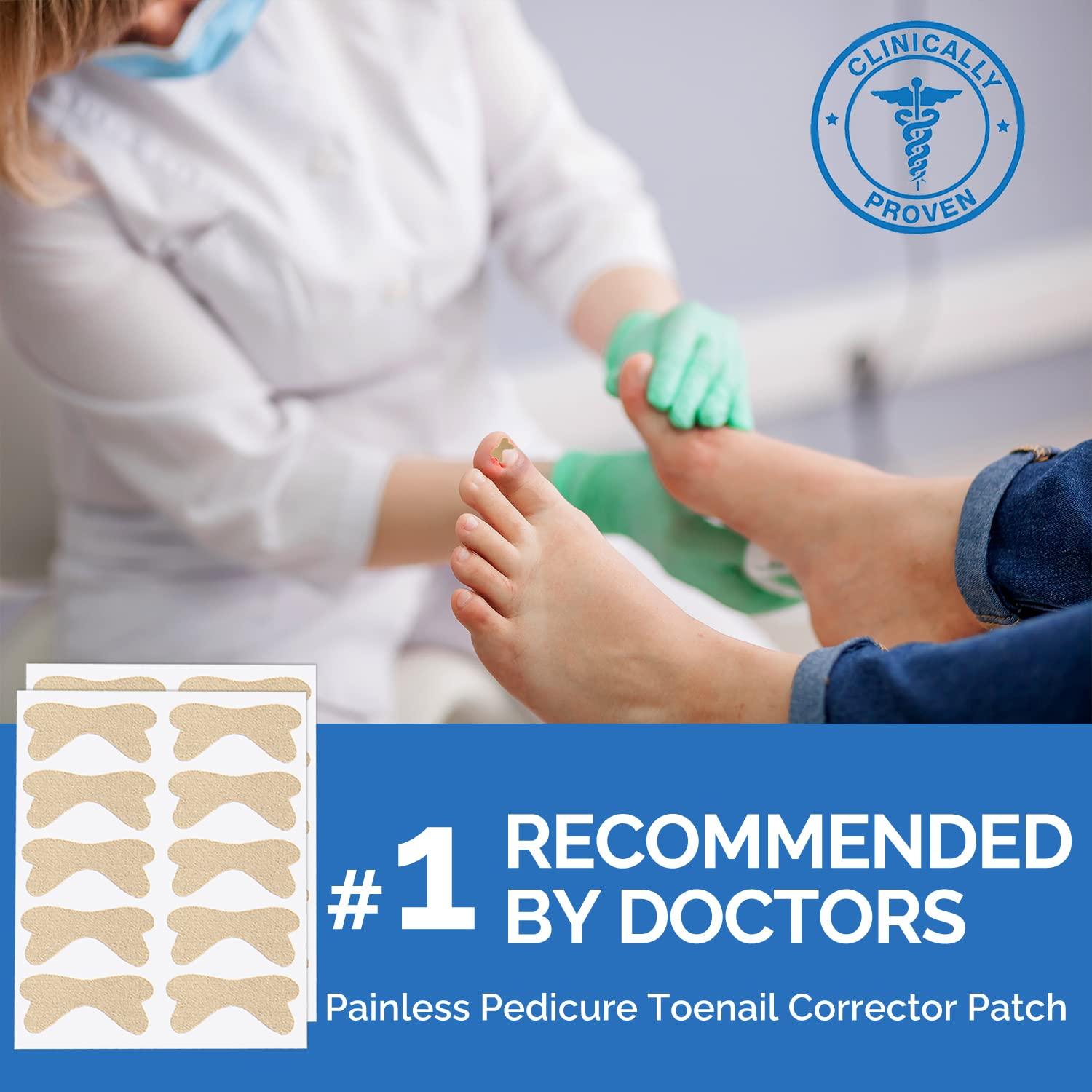 Ingrown Toenail Treatment Kit - 50Pcs No Glue Corrector Patch & Tools ...