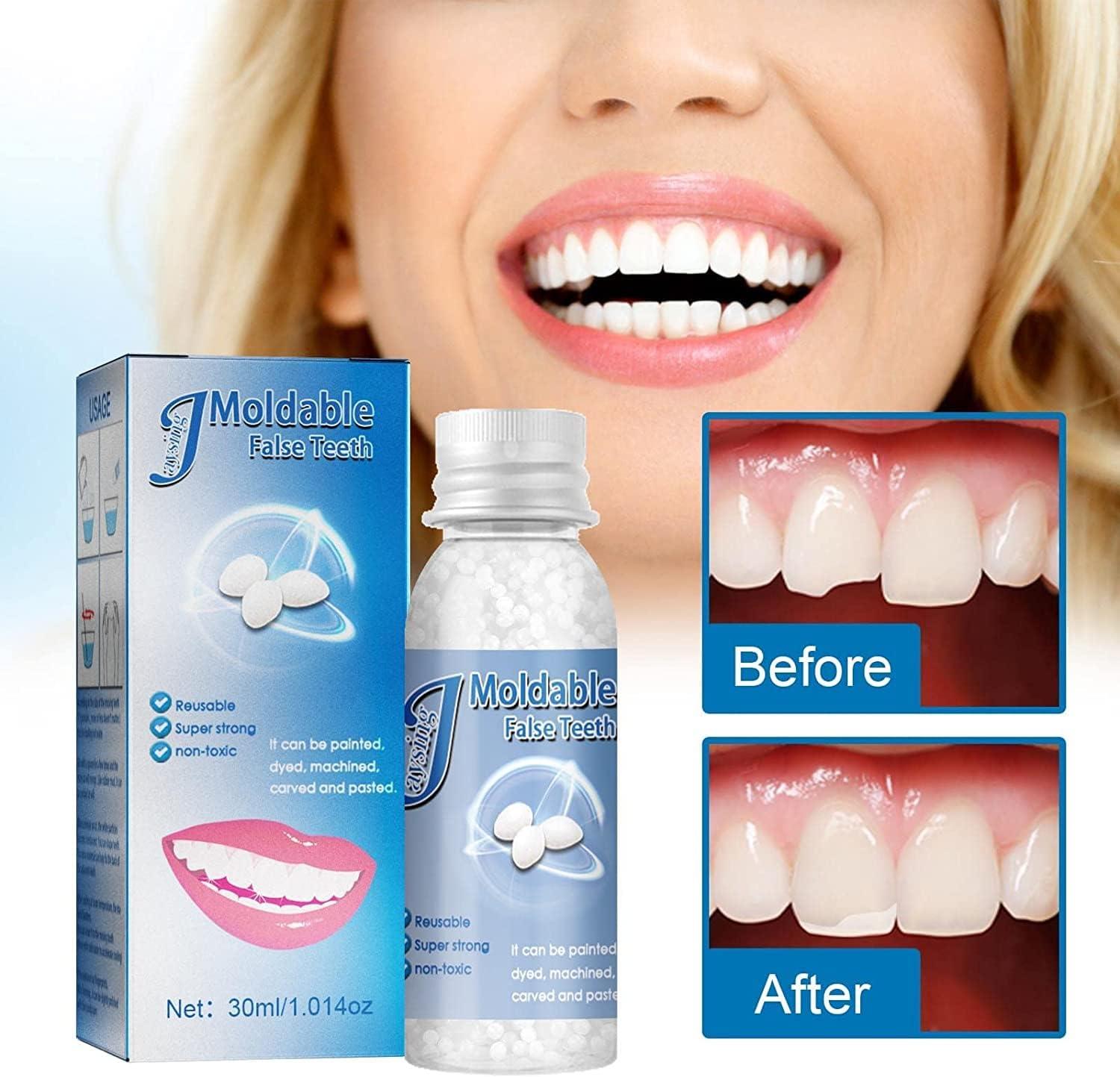 2023 Tooth Fix Kit 30ml - Moldable Thermal Fitting Beads for Temporary ...