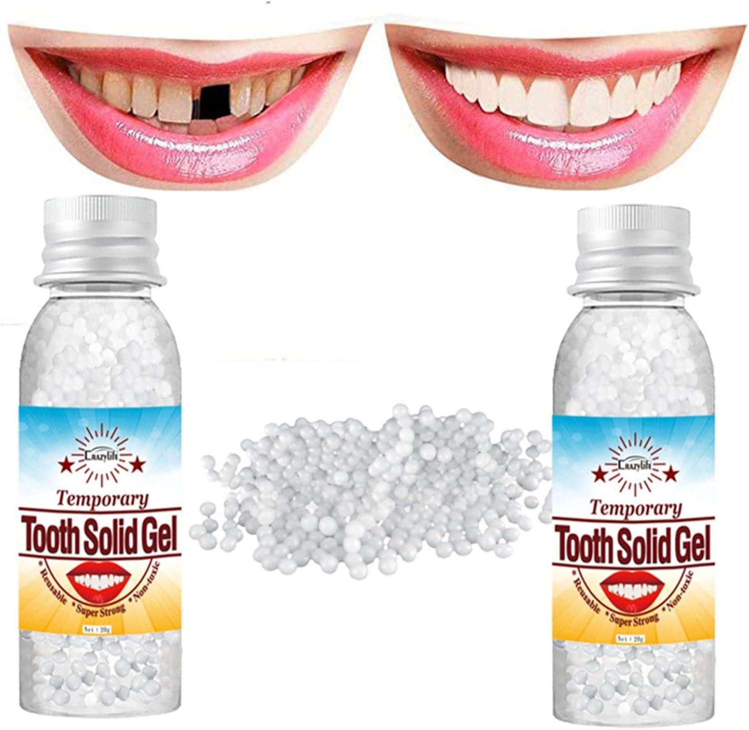 H.eternal Plastic Tooth Adhesive - Temporary Filling for Dentures | One ...