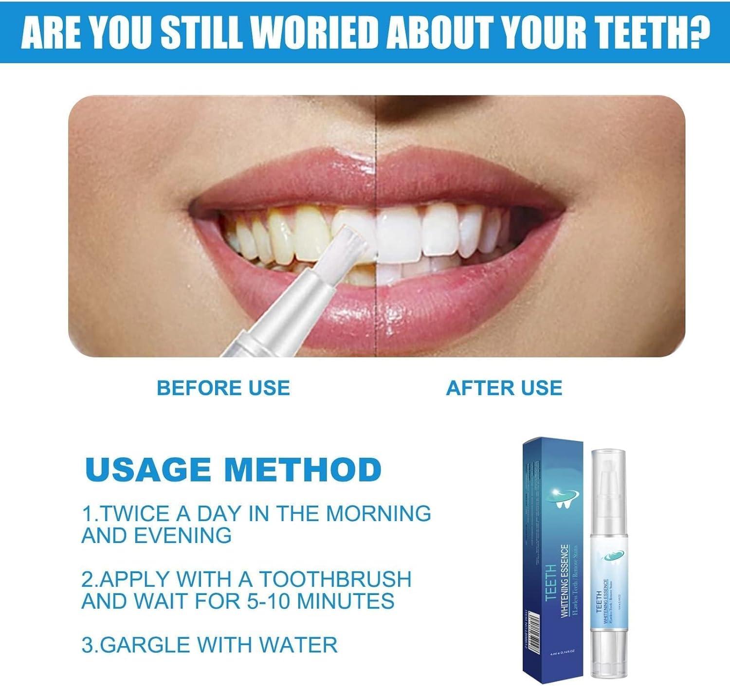 Marshmallow Meadows Tooth Elevator Essence - Gentle Tooth Whitening for ...